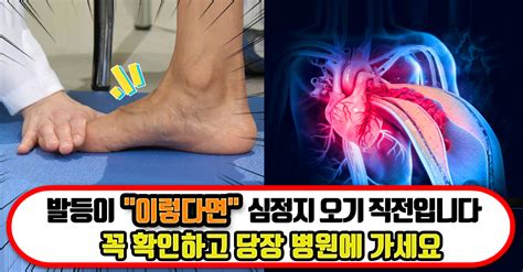 👉발등만 봐도 자신이 심혈관질환인지 바로 확인할 수 있습니다 심혈관질환 전조증상과 자가진단 방법 확인해 보세요