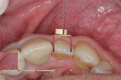 The Position Of The Camera Was Also Standardized Using The Device Download Scientific Diagram