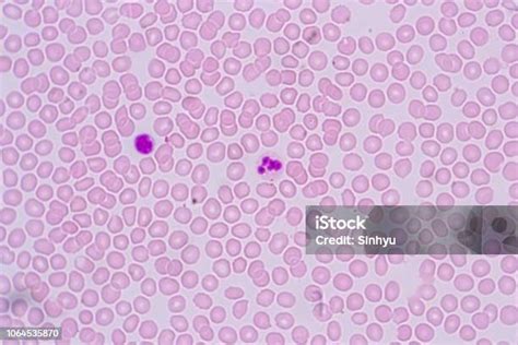 백혈구 세포의 연구는 실험실에서 현미경 면역 시스템의 세포 이다 백혈구에 대한 스톡 사진 및 기타 이미지 백혈구 건강 진단 건강관리와 의술 Istock
