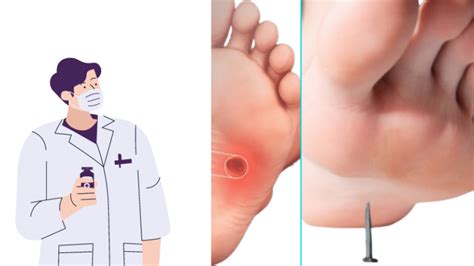 How Do You Get Tetanus From Rust Best Tetanus Support