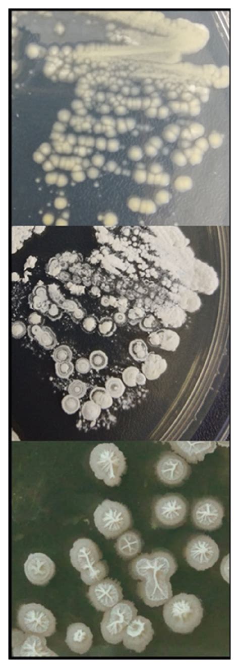 Representative Colony Morphology Of Isolated Colonies And Plates