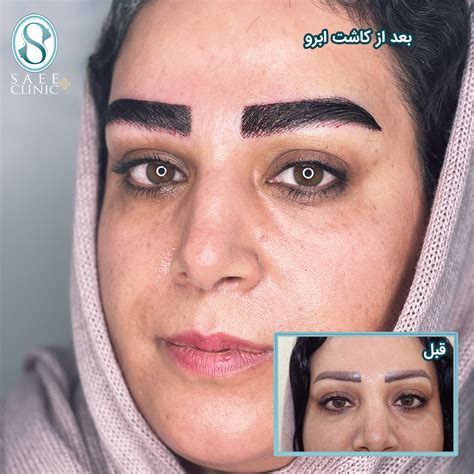 کلینیک ساعی کلینیک پوست و مو ساعی
