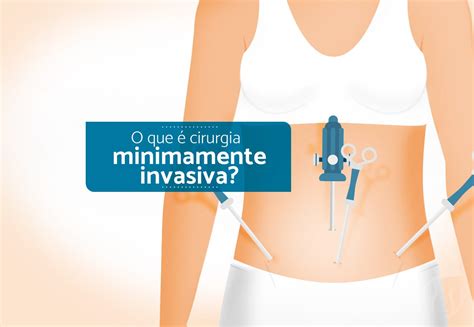 O Que é Cirurgia Minimamente Invasiva Dr Luiz Flávio
