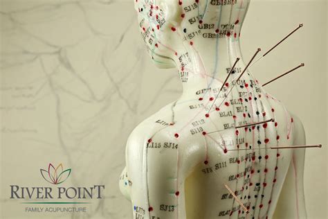 New Research Might Help Explain How Acupuncture Works River Point