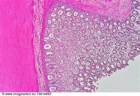 Human Vermiform Appendix Cross Section Showing Left To Right Human