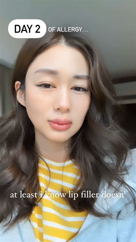 岑麗香一部位離奇腫脹！極近鏡拍攝現3d效果 突然「毀容」仲笑得出？ 星島日報