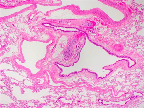 Pulmonary Artery Histology