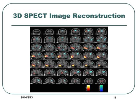 Ppt Image Reconstruction Methods Powerpoint Presentation Free