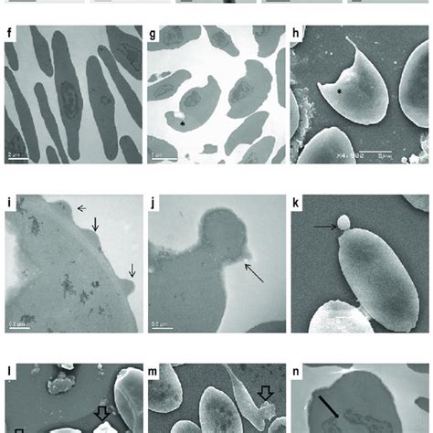 Antioxidant Enzyme Activity Levels Of Superoxide Dismutase Sod