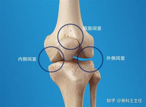 治疗骨关节炎，膝关节截骨术管用吗，好处和坏处是什么？ 知乎