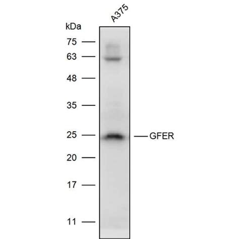 Solarbio K111716p Anti Gfer Polyclonal Antibody 试剂仪器耗材