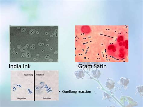 Streptococcus Pptx Chemistry Science Streptococcus Pptx Chemistry Science