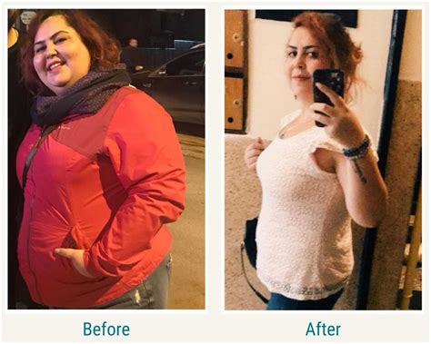 Gastric Bypass Imed Medical