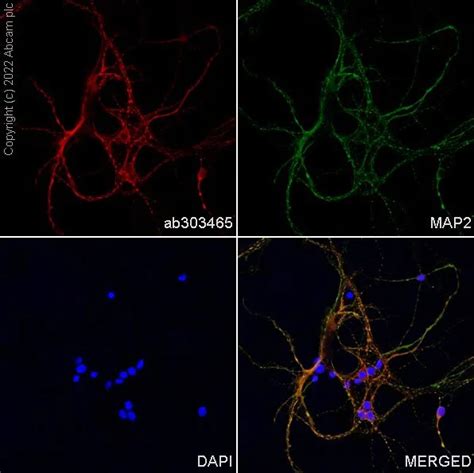 Alexa Fluor® 568 Anti Map2 抗体 Epr19691 Ab303465 Abcam