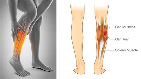 Health Remedies The Reason Why The Leg Cramps During The Night And