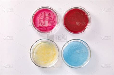 微生物实验室。装有各种细菌样本的培养皿