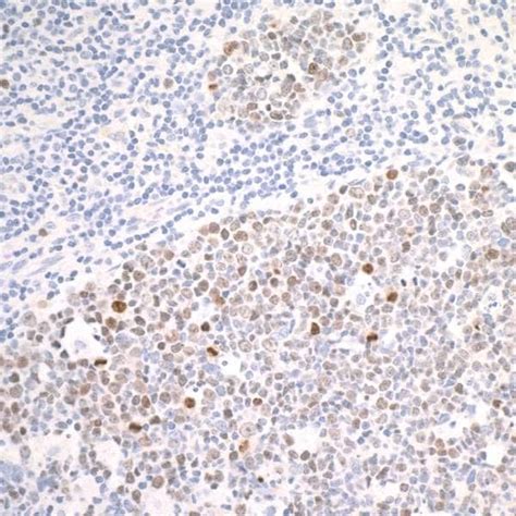 Results For Ki67 Abcam Antibodies Proteins Kits