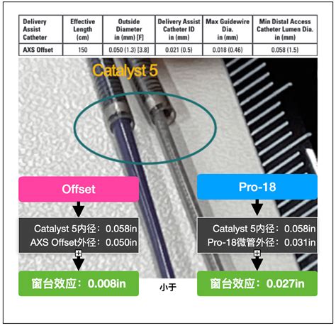 宣武crc星期五丨offset：“递送辅助导管”在ais中的应用cm技术血管