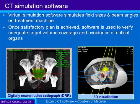 Ct Simulation Software 6