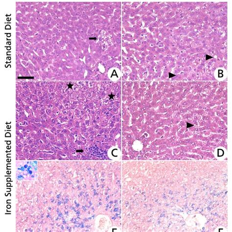 Photomicrographs Of Histological Pancreatic Sections A Control