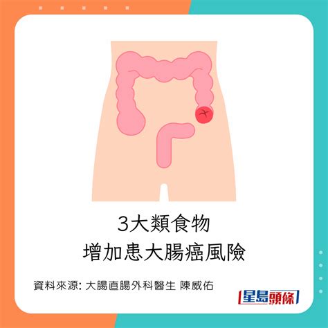 大腸癌症狀｜大便黏馬桶患大腸癌？ 出現6情況高危 醫生教分腸胃病腸癌 星島日報