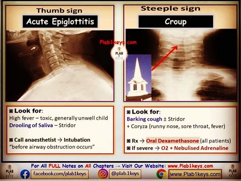 Plab 1 Keys • Exam Oriented Notes High Yield Coloured