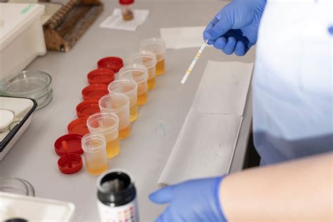 Prueba De Vitamina B12 Compass Imaging Lab