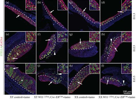 The Location Of Germ Cells Was Disrupted In Wt1 Flox Cre Ertm Gonads