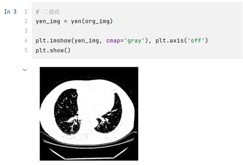 【cv作业05】肺部区域提取ct 肺部轮廓提取 Github Csdn博客