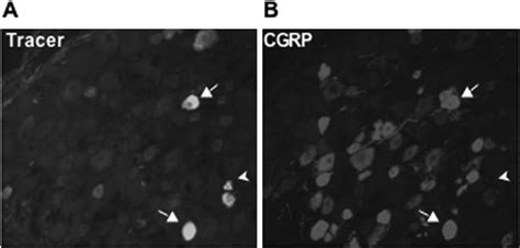 Tracer Labeled Cgrp Ir Neurons In The L4 Drg A Labeled Sensory Download Scientific Diagram
