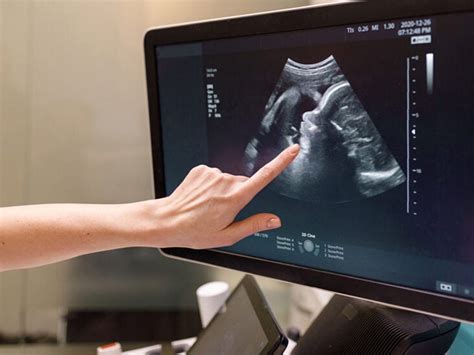 25 Weeks Pregnant Ultrasound
