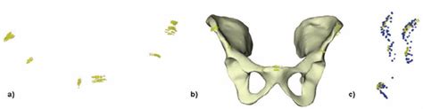 A Point Clouds Derived From Ultrasound Images Acquired From Cadaveric