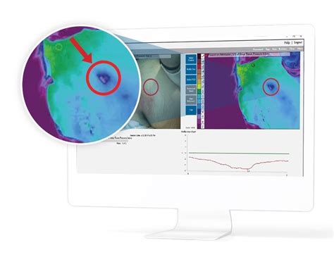 Wound Imaging Wound Documentation Wound Measurement Solutions