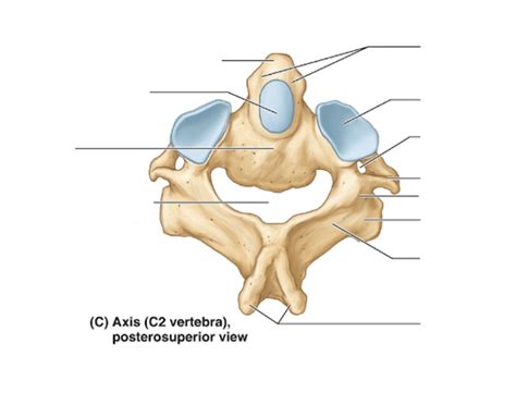 Axis C2 Vertebra Posterosuperior View Quiz