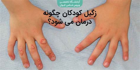 قرص اورژانسی؛ بهترین زمان و نحوه مصرف عوارض خطرناک