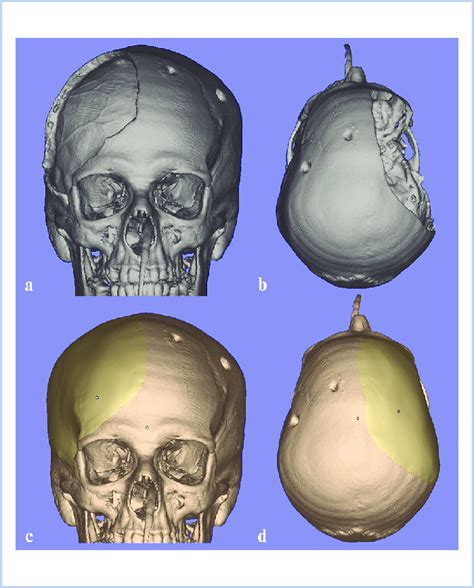 result of the second modeling option a b polygonal models before