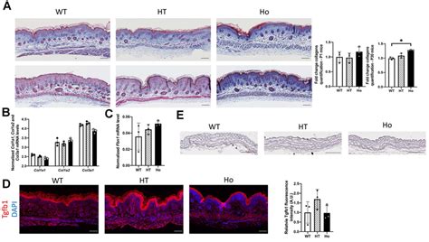 Skin And Aortic Phenotypes In Fbn1 Y1698c Mutant Mice Massons