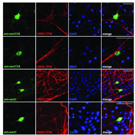 The Oncosphere To Metacestode Metamorphosis In Different Tapeworms A Download Scientific