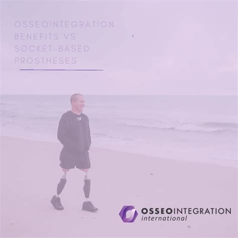 Osseointegration International On Linkedin Osseointegration Osseointegrationinternational