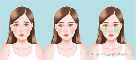 皮肤活检到底有啥用为什么被称作皮肤病界的黑科技 知乎
