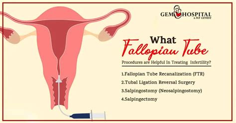 Fallopian Tube Blockage