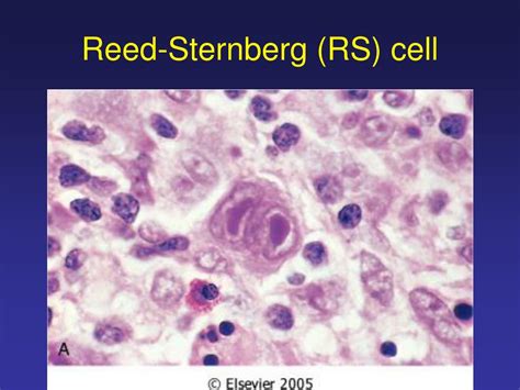 Ppt Leukopenia Leukocytosis Powerpoint Presentation Id425635