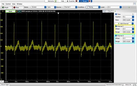Diy Ecg Using An Analog Discovery 2 And Labview Digilent Blog