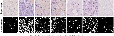 Figure 1 From Breast Tumor Cell Nuclei Segmentation In Histopathology Images Using