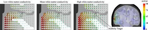 current density for auditory cortex stimulation for different values of