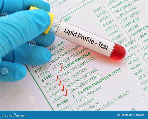 Lipid Profile Test Stock Image Image Of Laboratory 101048215