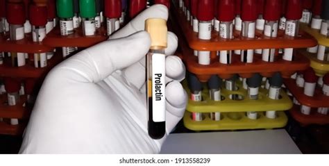 Ovarian Hyper Stimulation Photos Images And Pictures Shutterstock