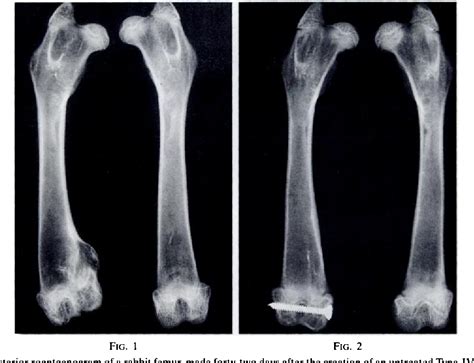 Figure 1 From Experimental Physeal Fracture Separations Treated With Rigid Internal Fixation