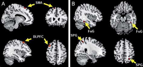 Figure 2 From Neural Correlates Of Emotion Cognition Interaction During