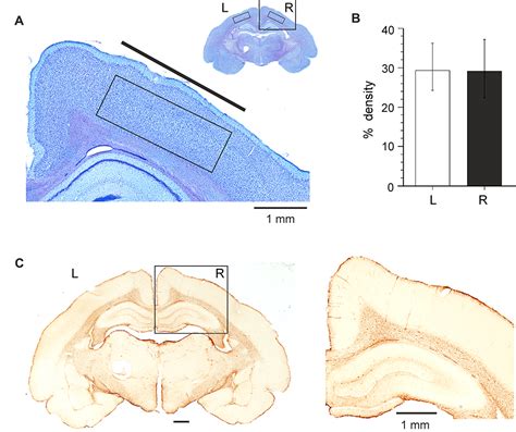 Recording Electrical Brain Activity With Novel Stretchable Electrodes Ijn